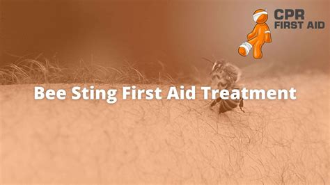 Bee Sting First Aid Treatment Cpr First Aid