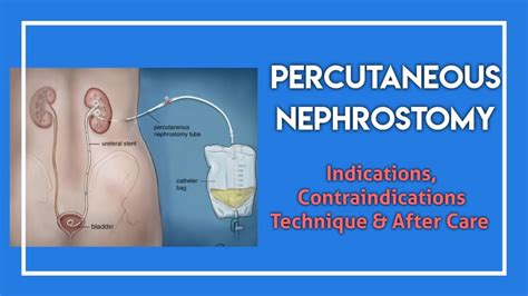 Percutaneous Nephrostomy Indication Contraindication Technique Aftercare Pcn Nephrostomy
