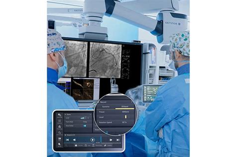 Ahmed Taher On Linkedin 3dstent Kuwait Gha Allia Gehealthcare