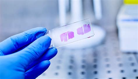 Thyroid Hormone Shows Promise For Fighting Liver Disease Futurity