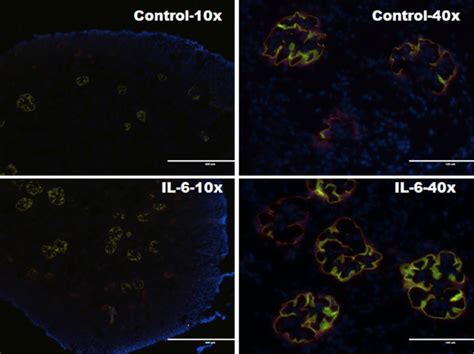 Double Immunofluorescence Staining With Podocyte Proteins Podocalyxin Download Scientific