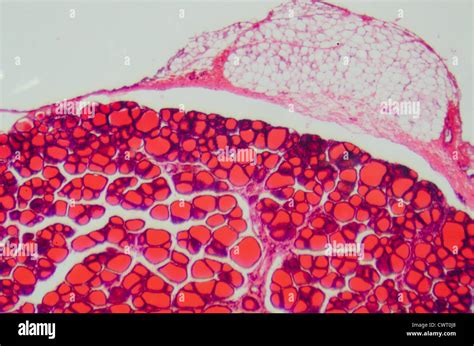 Science Medical Anthropotomy Physiology Microscopic Section Of Thyroid