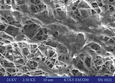 Poly L Lactic Acid Poly ε Caprolactone Pllapcl Nanofibrous Scaffold Download Scientific