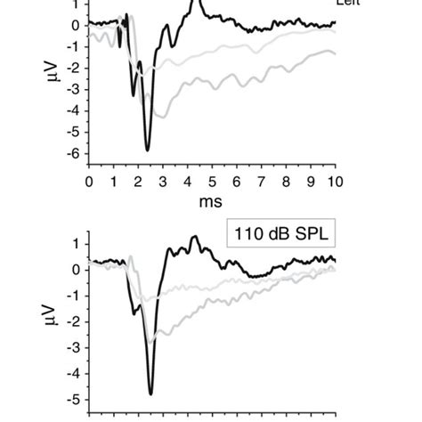 Visual Reinforced Audiometry Abrs And Dpoaes From Subjects 3 Squares Download Scientific