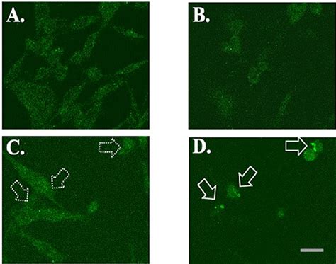 Intracellular Detection Of Singlet Oxygen Using Fluorescent Nanosensors Pmc