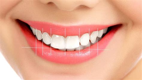 What Is Smile Analysis Dentart Implant And Esthetic Dentistry