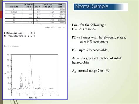 Hplc Interpretation Ppt Hplc Interpretation Ppt