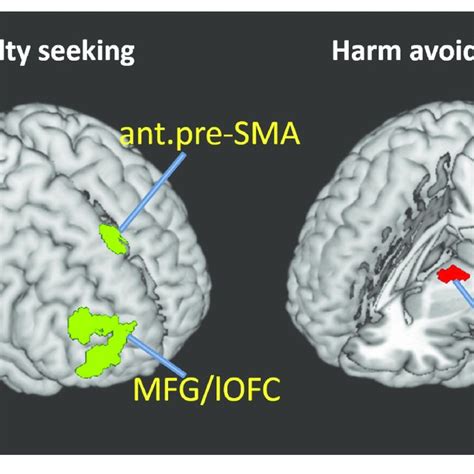 Neural Correlates Of Proactive Control That Negatively Correlate With