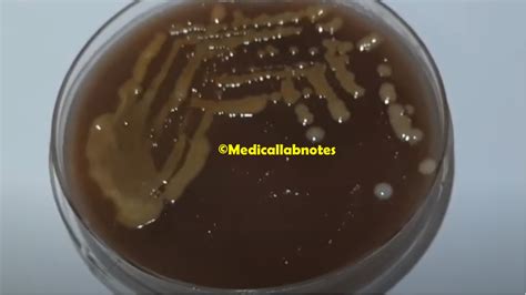 Cryptococcus Neoformans Introduction Morphology Pathogenicity
