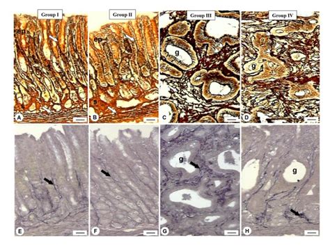Histochemical Analysis Of Reticular A D And Elastic Fibers E H In Download Scientific