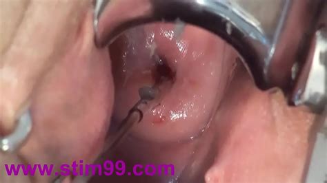 Cervix Fucking Play Deep Japanese Asiatique å å®®é Andéƒanddoubledotã‚¯ã‚and