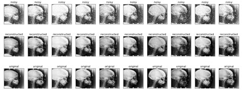 Github Sm823zwnoise Removal From Medical Images In This Repository