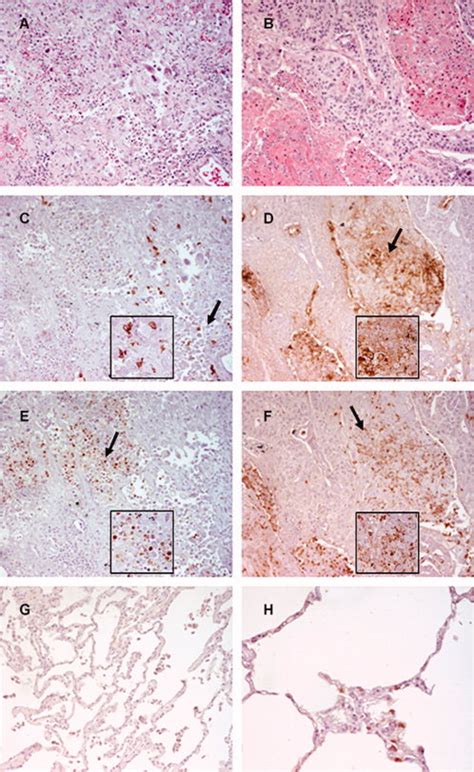 Neutrophils Are Recruited To Sialyl Lewis X Slex Positive Areas Of Download Scientific