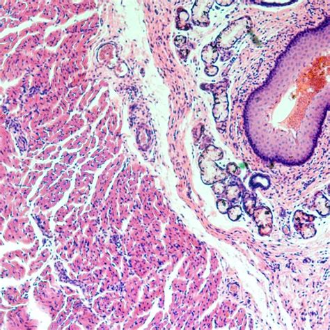 Stratified Squamous Epithelium Stock Photo Panxunbin