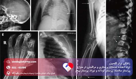 مشکلات ارتوپدی کودکان درمان مشکلات پای کودکان