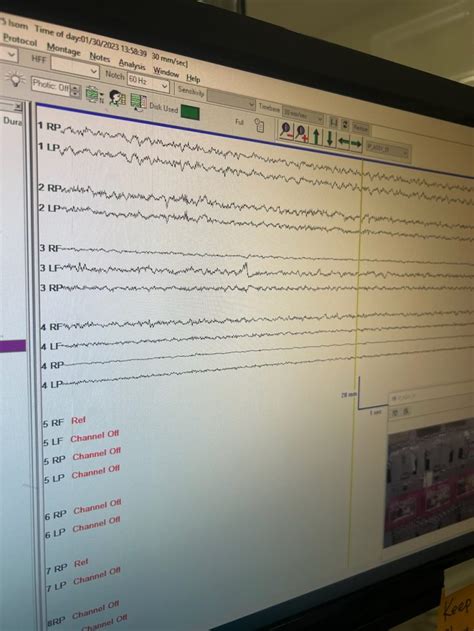 first eeg recording mattis lab