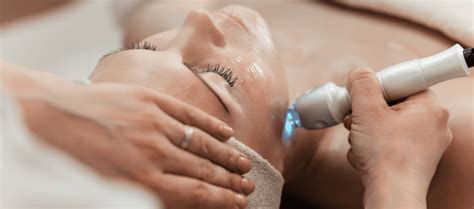 Fractional Radiofrequency Melbourne Kew Dermatology