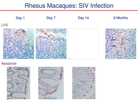 Ppt Microbial Translocation And Hiv Siv Infections Powerpoint Presentation Id 3823394