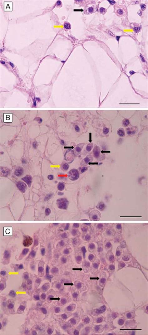 Figure 1 From Partial 18s Rrna Sequences Of Apicomplexan Parasite X Apx Associated With