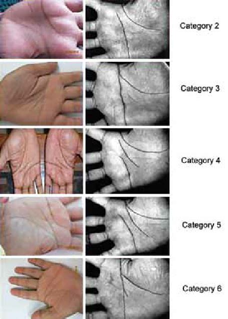 Frequency Of Palmprint Patterns In The Right Palm Download Scientific