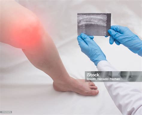 의사 정형 외과 의사는 아픈 무릎이있는 여성의 초음파 사진을 유지합니다 고나르스로시스 관절염 클로즈업 카피 스페이스 염증 건강 진단에 대한 스톡 사진 및 기타 이미지