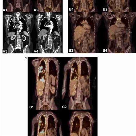 Examples Of Her2 Exon 20 Mutations Download Scientific Diagram