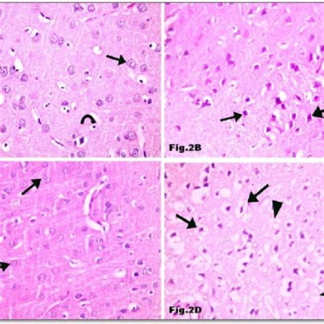 A Section Of The Frontal Cortex Showing The Pyramidal Neurons With Download Scientific