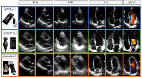 Comparison Of Main Handheld Echocardiographic Systems Available Plax Download Scientific