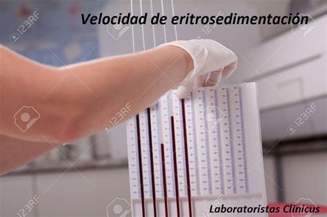 Velocidad De Eritrosedimentacion Laboratoristas Clinicus Facebook