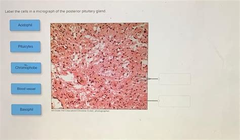 Solved Label The Cells In A Micrograph Of The Posterior