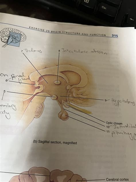 Sagittal Section Diagram Quizlet