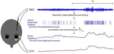 Microelectrode Recording Mer And Electrooculography Eog Signal Download Scientific Diagram