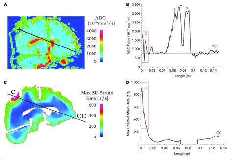 Correspondence Between ADC Values From Clinical Data And Simulated Download Scientific