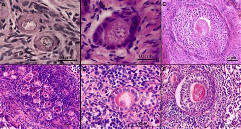 Photomicrograph Of The Ovary Cortex A C Preantral Follicles From