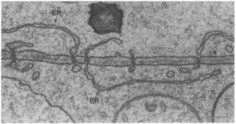 Electron Micrograph Of Primary Plasmodesmata From Zea Mays Root Tip