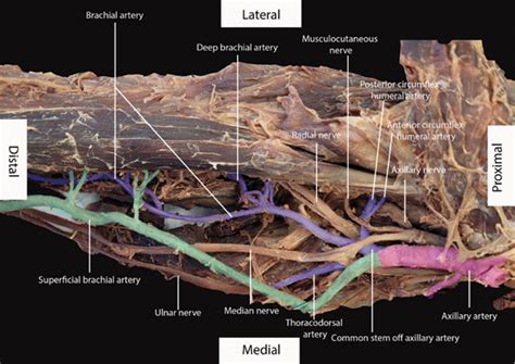 Brachial Plexus Cadaver Diagram