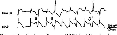 Structure Of Endocardium Of Left Ventricle Semantic Scholar