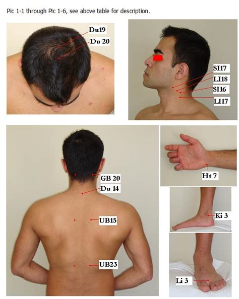 Neck Acupressure Points Trigger Points In Neck And Injections
