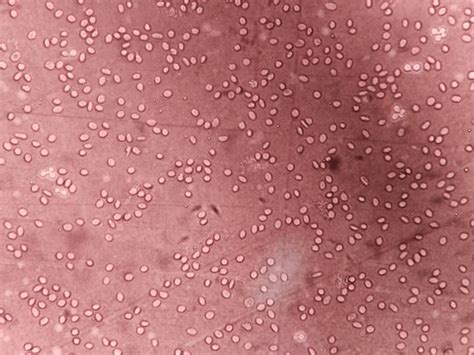 10 Immagini Foto Stock Oggetti 3d E Immagini Vettoriali Cerebrospinal Cryptococcus Shutterstock