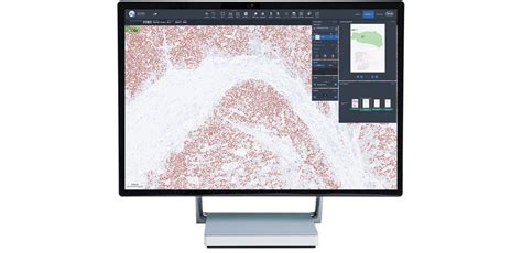 Upath Her2 4b5 Image Analysis