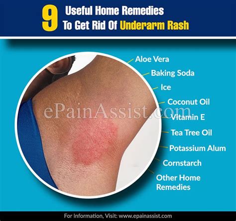 How To Prevent Heat Rash In Armpits At Roderick Wilkerson Blog