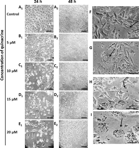 Cell Morphology Study Of Hct 116 At Varying Concentrations Of Qc And