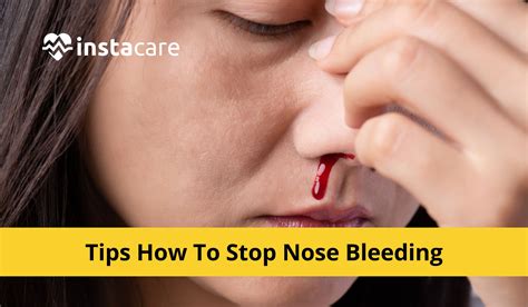 Tips How To Stop Nose Bleeding