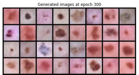 github liangkunn generative models in medical images a repository for data augmentation in