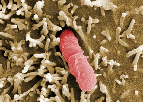 Yersinia Pseudotuberculosis Alchetron The Free Social Encyclopedia