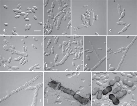 Aureobasidium Pullulans Var Namibiae A Conidia B F Liberated Download Scientific Diagram
