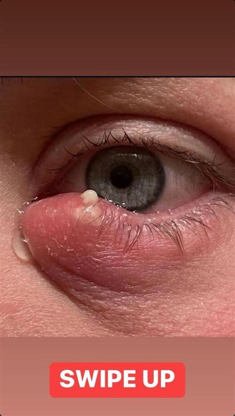 Is There A Recently Discovered Lethal Insect Species That Creates