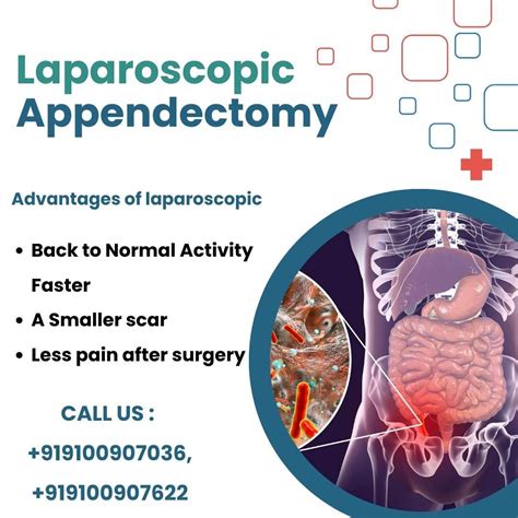 Laparoscopic Appendectomy Medifyhome