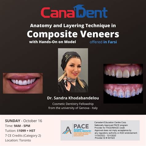 Anatomy And Layering Technique In Composite Veneers Canadent