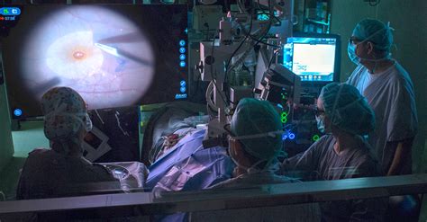 3d Visualization Systems Precision And Efficiency In Ophthalmic